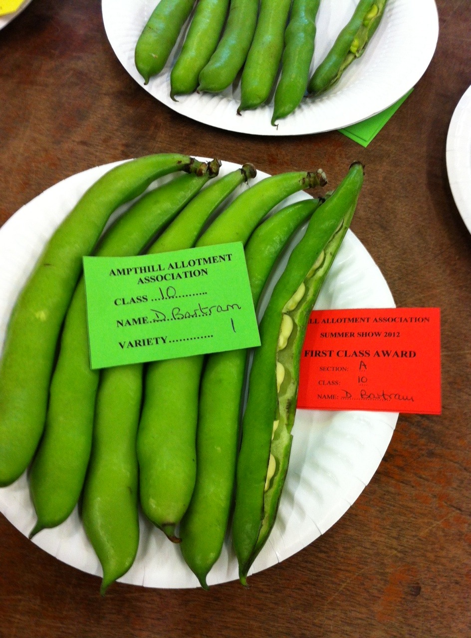 Aortic Dissection diagnosis in Emergency Medicine - St Emlyns