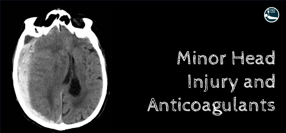 Anticoagulants and Minor Head Injury