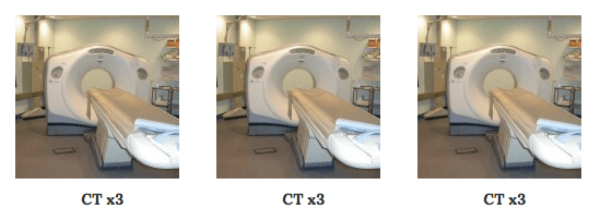 JC: Triple Rule Out CT - are the rays worth it? St.Emlyn's • St Emlyn's