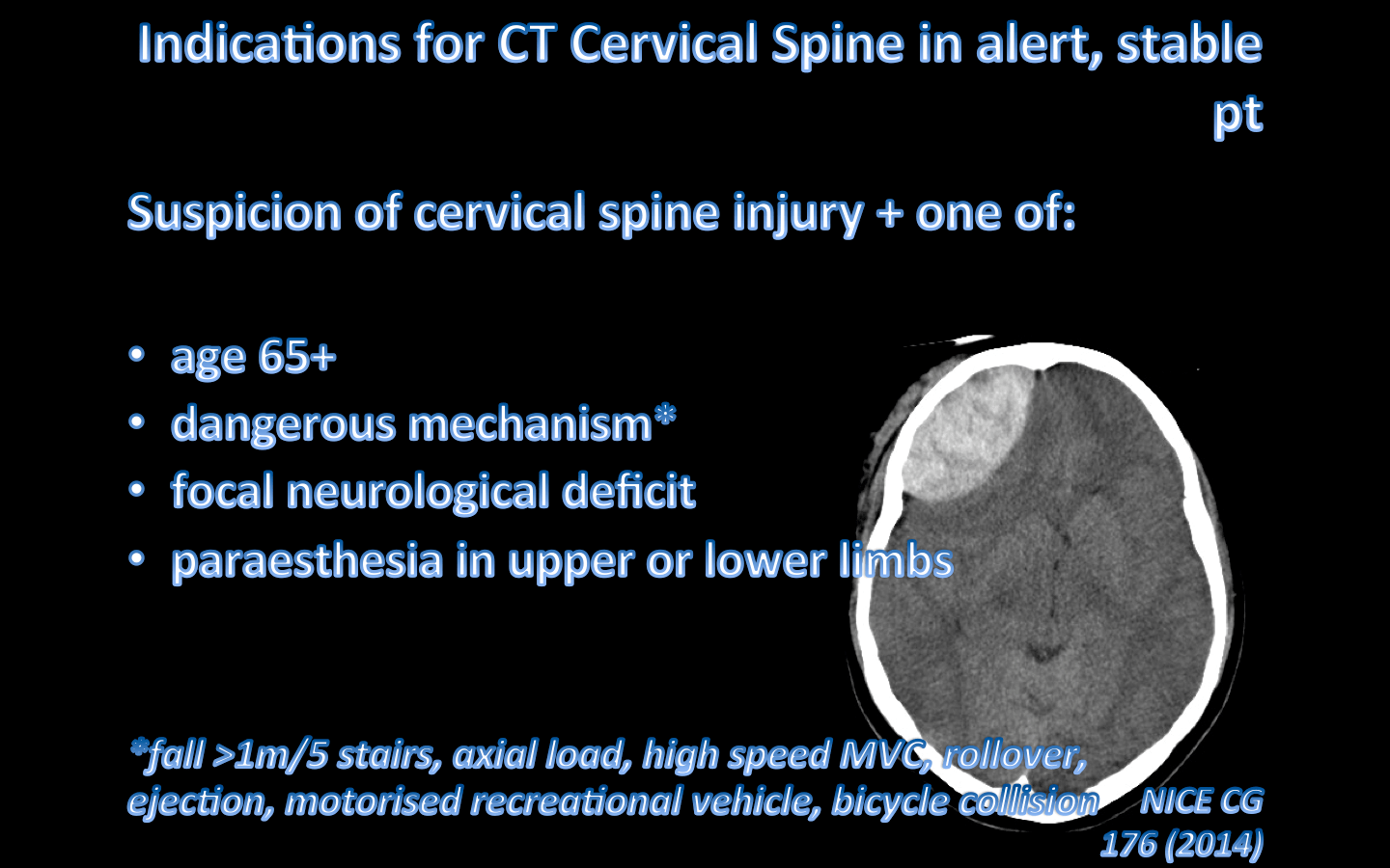 Updated NICE Head Injury Guidelines - Worth a Scan?
