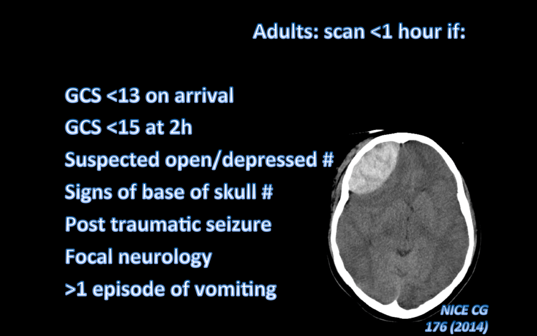 Updated NICE Head Injury Guidelines - Worth a Scan?