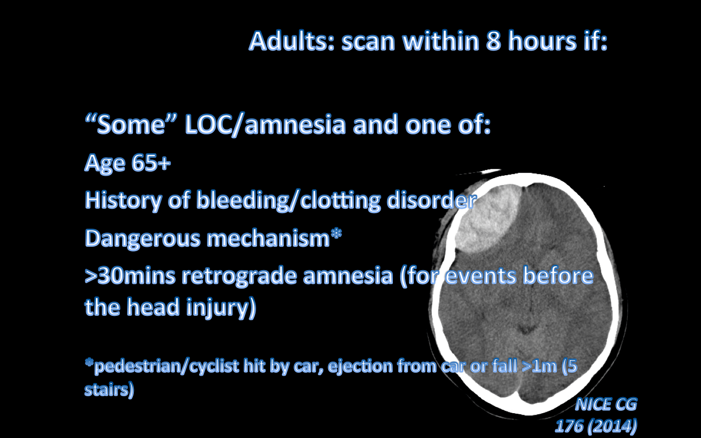 Updated NICE Head Injury Guidelines - Worth a Scan?