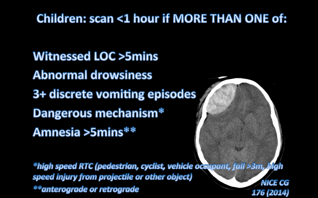 Updated NICE Head Injury Guidelines - Worth a Scan?