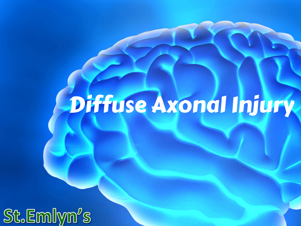 All Shook Up - Diffuse Axonal Injury with John Hell • St Emlyn's
