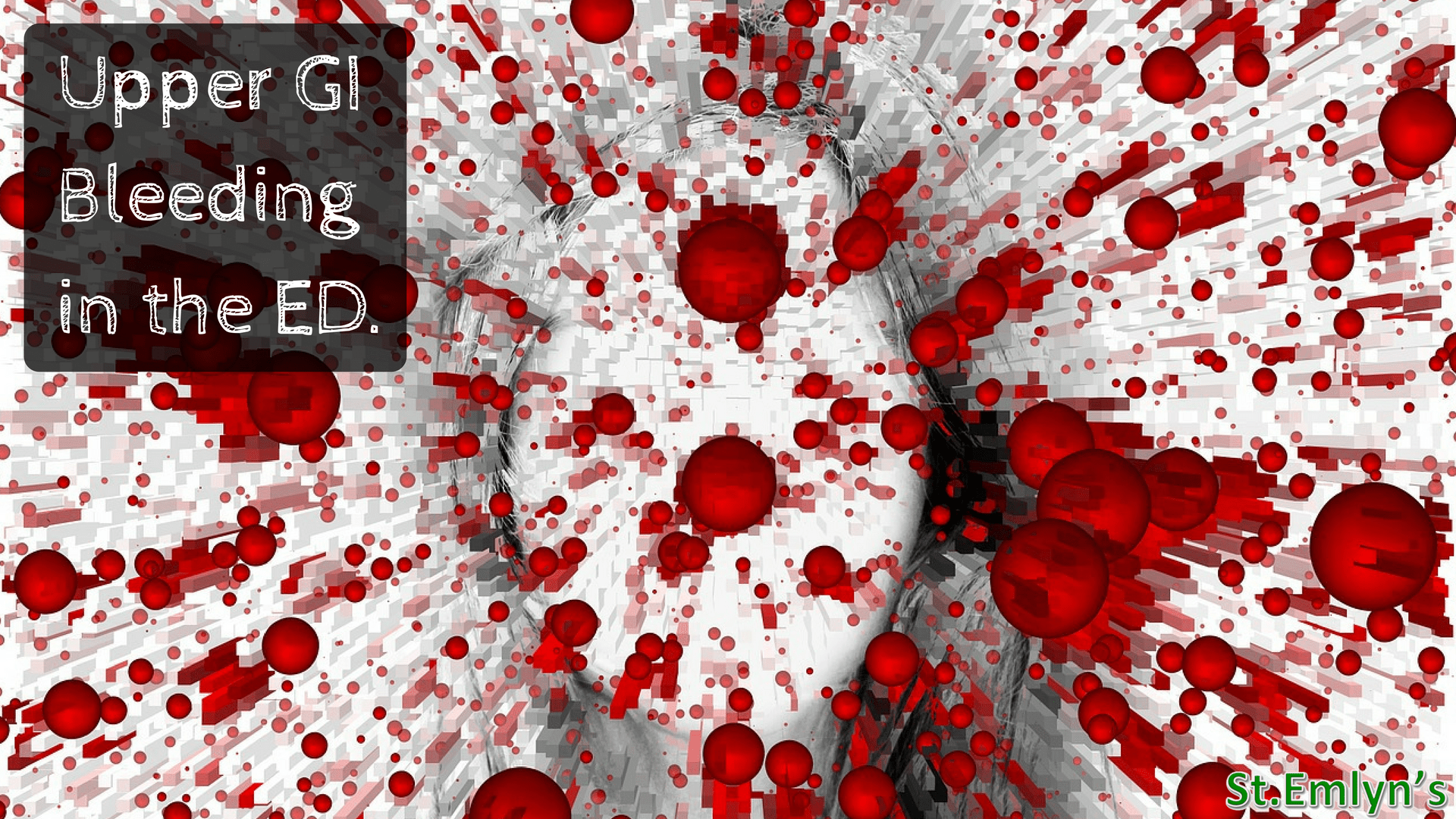 Upper Gastro Intestinal Bleeding at St.Emlyn's.