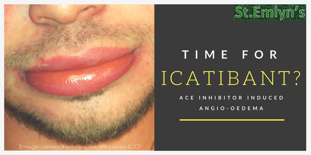 Icatibant for ACE inhibitor induced angioedema