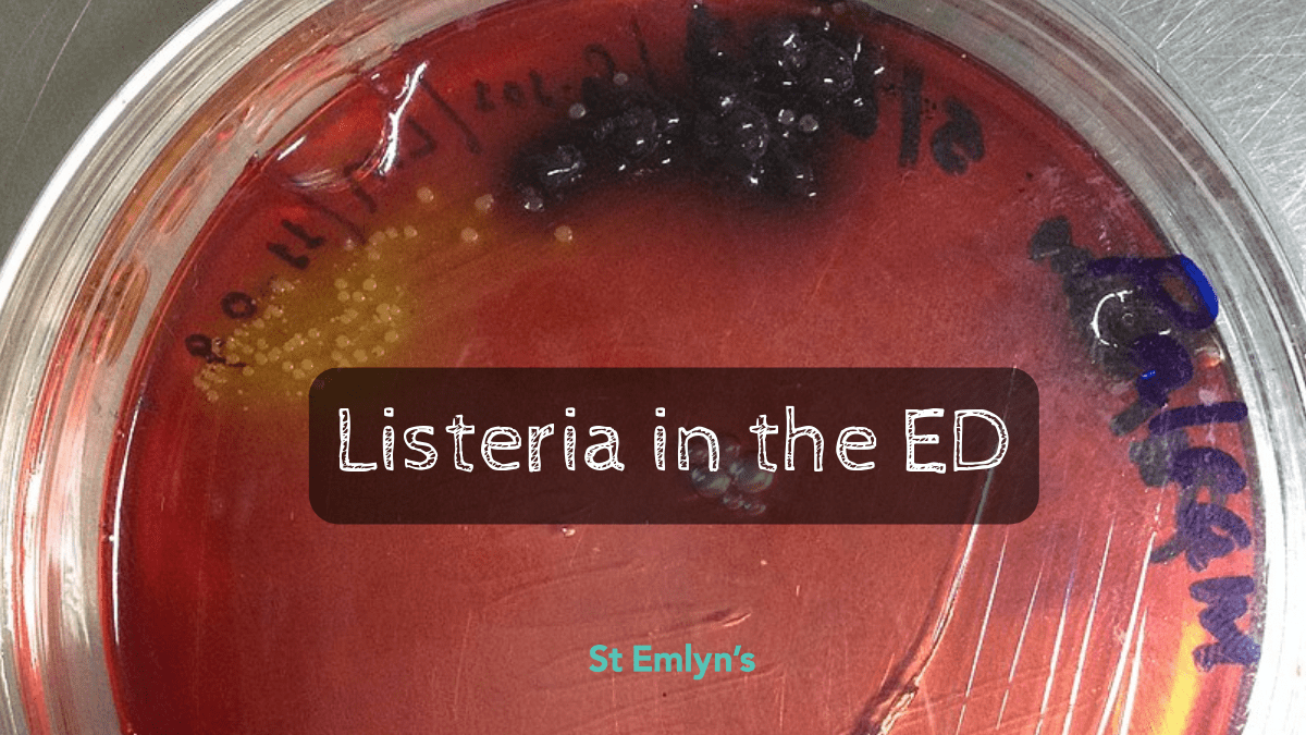 All you need to know about Listeria. St Emlyn's.