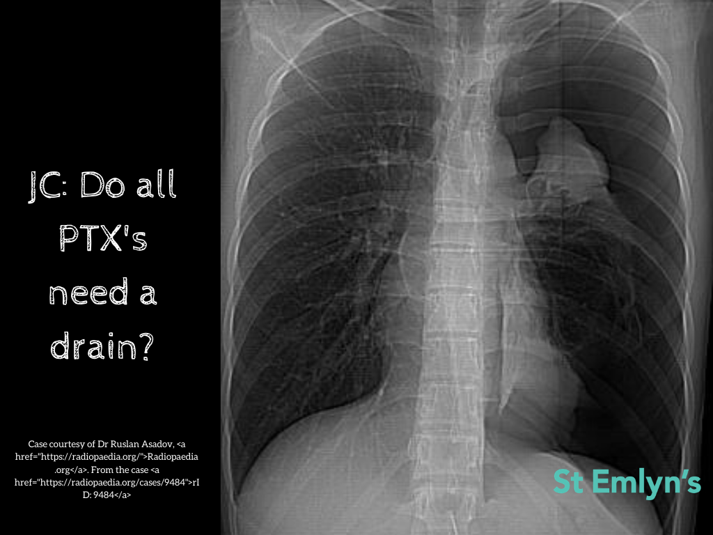 JC: Conservative management of pneumothoraces.