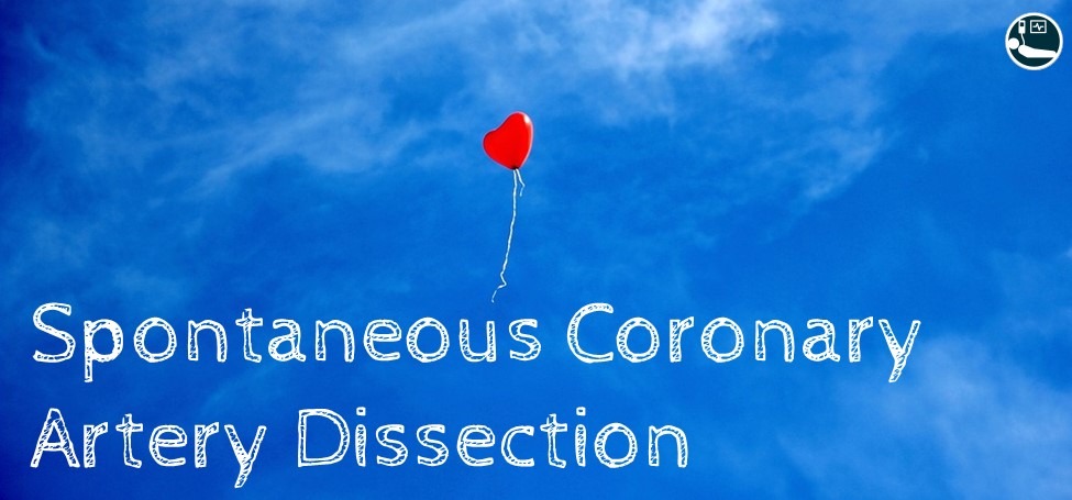 Spontaneous Coronary Artery Dissection (SCAD)