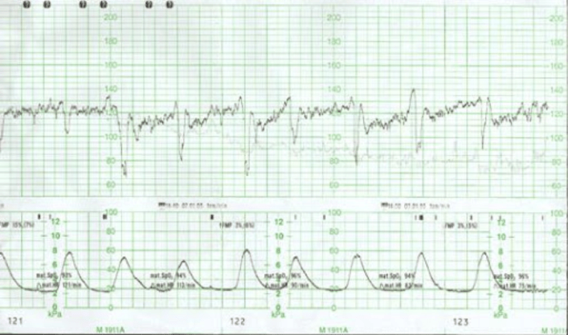 Trauma in pregnancy: Core knowledge and key skills. St Emlyn’s - St.Emlyn's