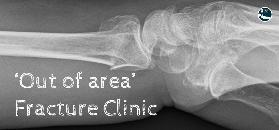 Fracture Follow Up - How to organise this for patients who are 'out of ...
