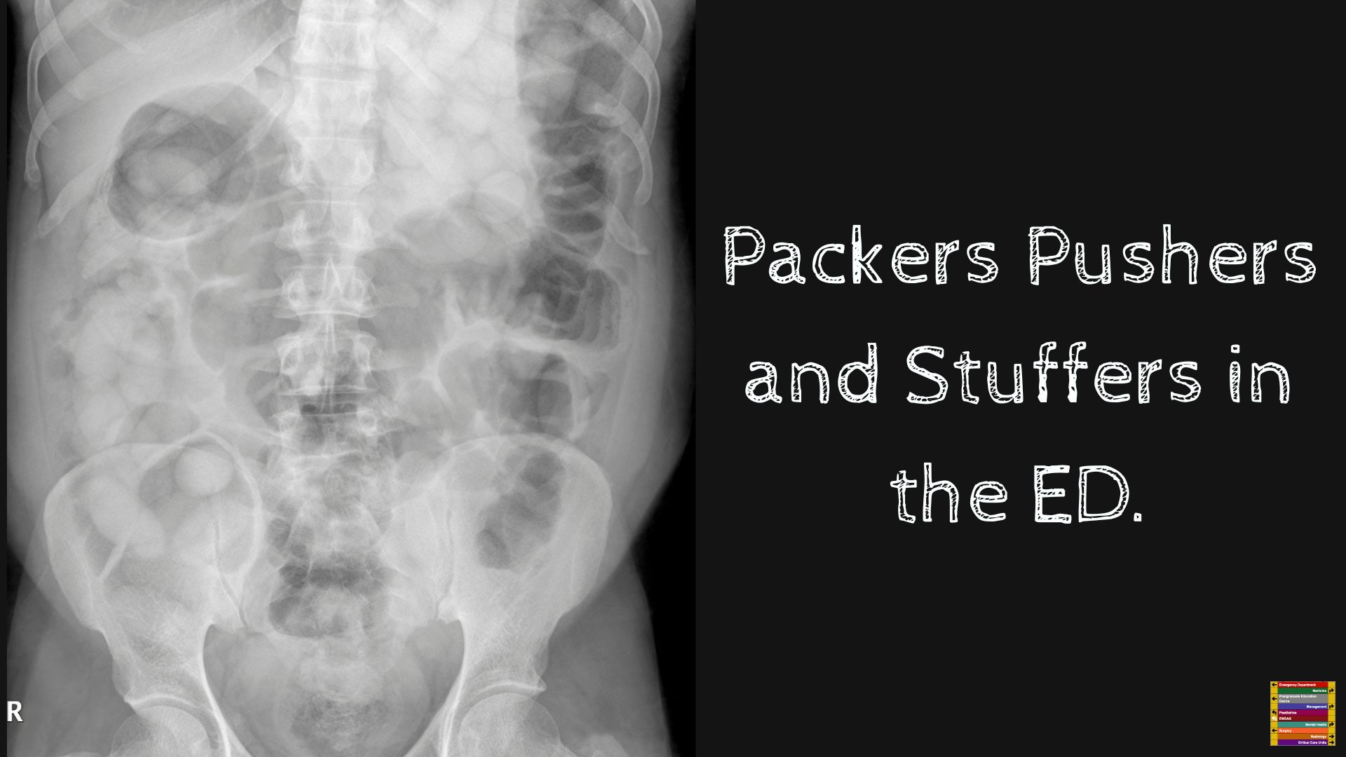 Packers, Pushers and Stuffers - Drug Concealment in the ED