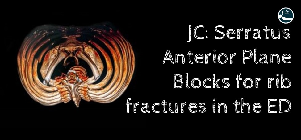 Serratus Anterior Plane Blocks