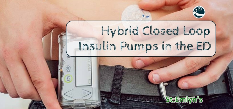 Podcast - Hybrid Closed Loop Insulin Pumps in the ED